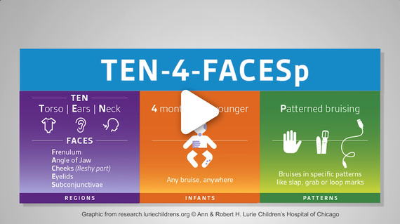 Recognize Child Abuse Injuries and Save Lives with TEN-4-FACESp